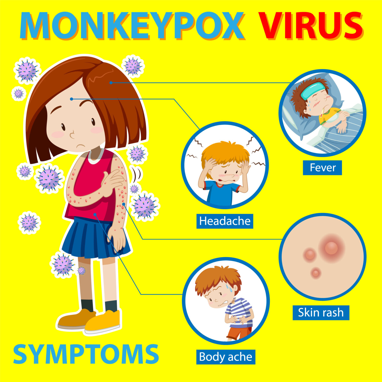 Virusul mpox Clada Ib se extinde în Europa: ce trebuie să știi înainte ...